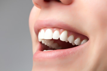 Gums Bleaching: How to whiten your teeth using chewy gum. - Share Your ...